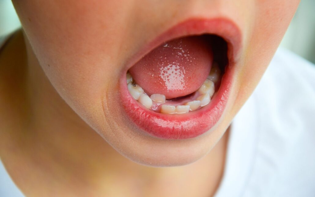 - Smiling Kids Pediatric Dentistry / IndianapolisSmiling Kids Pediatric ...